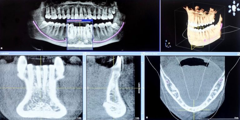 DVT/3D - Röntgen - Dr. med. Daniel Fornefett & Kollegen